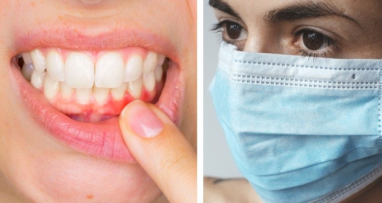 “Mask Mouth” – Dentists Warn Gum Disease and Tooth Decay Have Increased ...